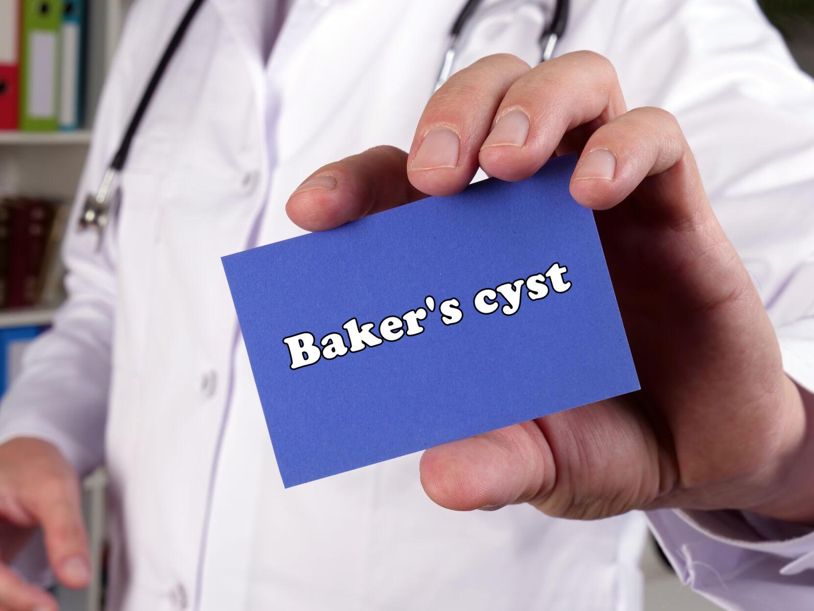 Baker’s cysts cause swelling behind the knee | Health | dailyitem.com