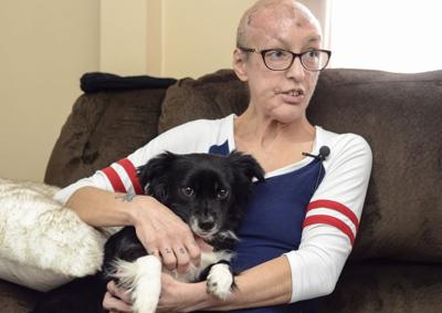 Benefit barbecue, music, auction set for bear attack victim | Applause ...