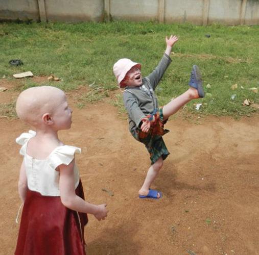 Dr. Ashley Risner helps children with albinism with their vision during ...