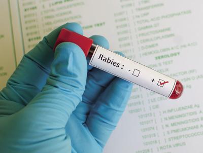 2 more positive rabies cases in Kerr County | Local News | dailytimes.com