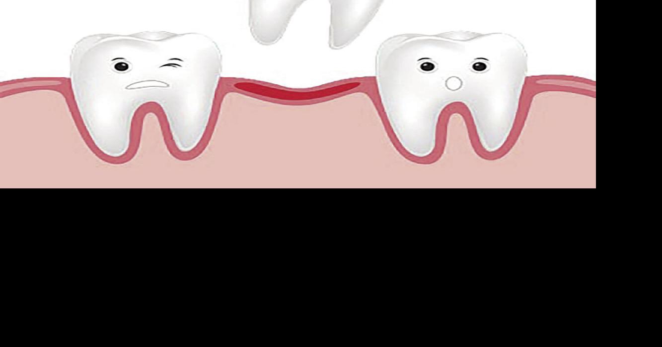 Missing teeth can impact overall health | Features | dcourier.com