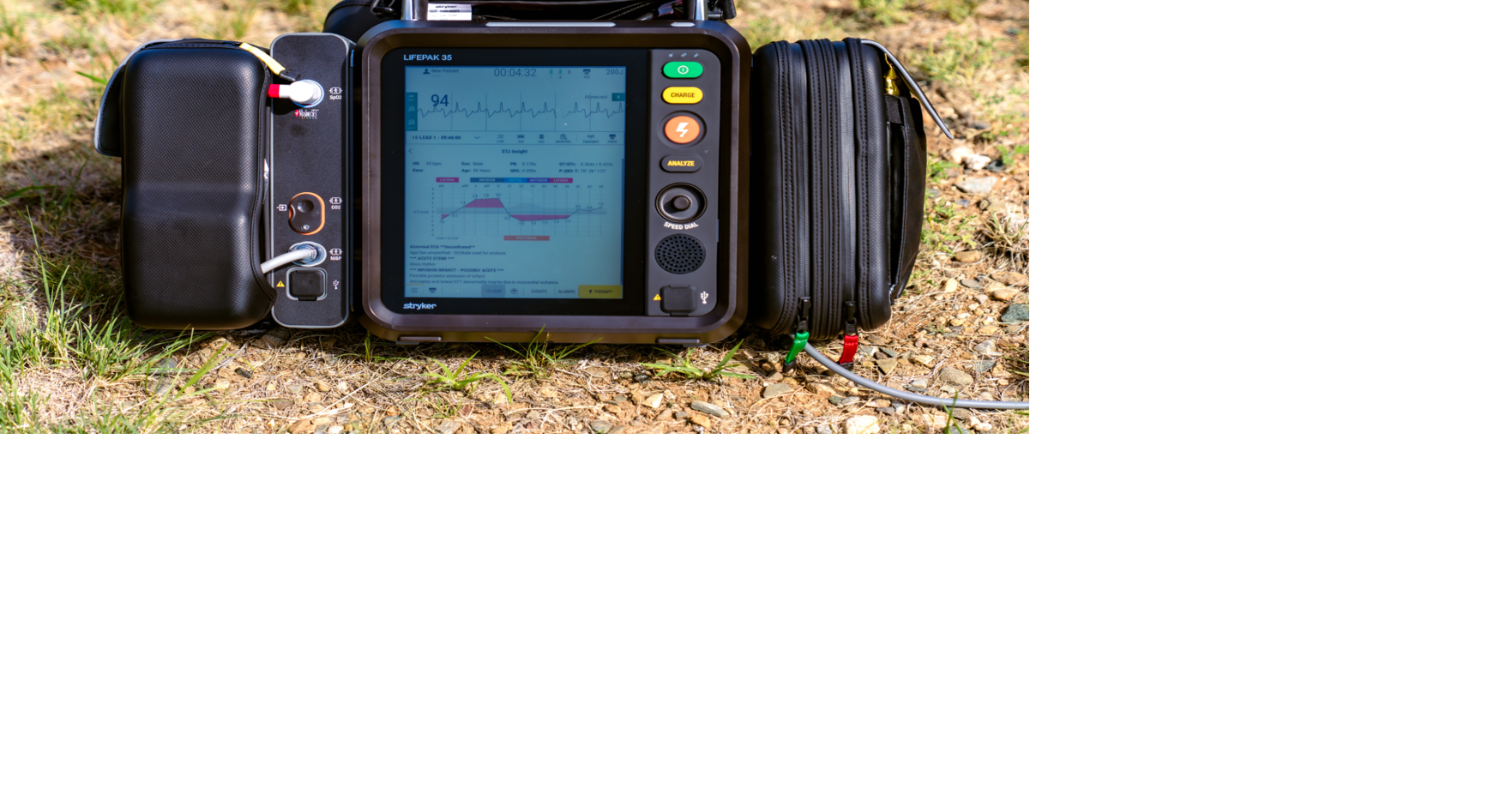 CAFMA now equipped with state-of-the-art heart monitor-defibrillators ...