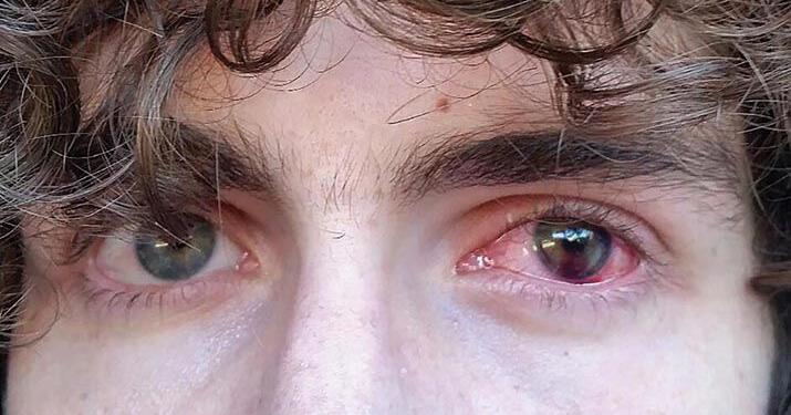 Man shot in eye during Verde Village drive-by shooting | News ...