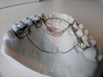 Kaiser Health News: FDA looks into dental device after KHN - CBS News ...