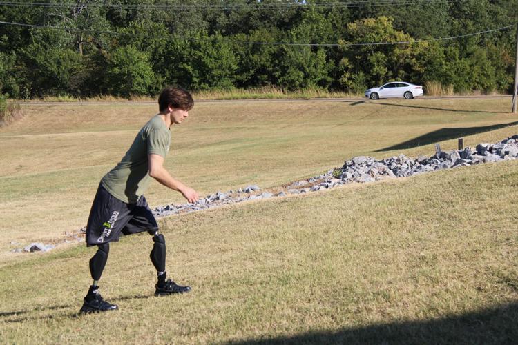 Dream Team Prosthetics unveils newest technology | Community ...