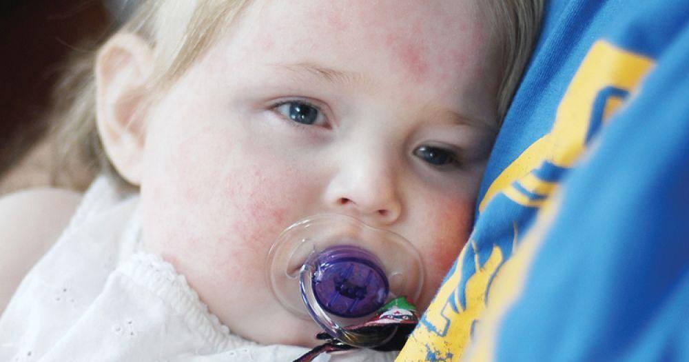 Whitby family takes on advocacy, support for rare syndrome