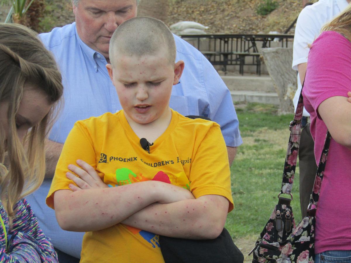 11-year-old bee attack victim celebrates homecoming | Local News ...