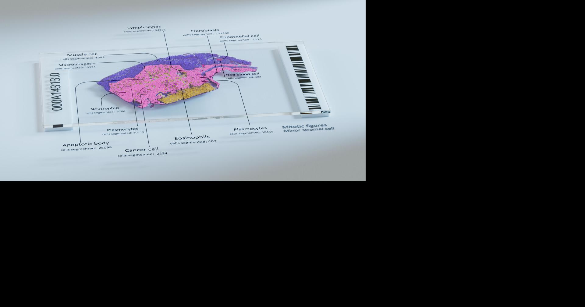 Owkin's Specialized Biological AI Agent Pathology Explorer Launches ...