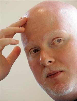 Albino rapper trumps race with rhymes | Get Out | eastvalleytribune.com