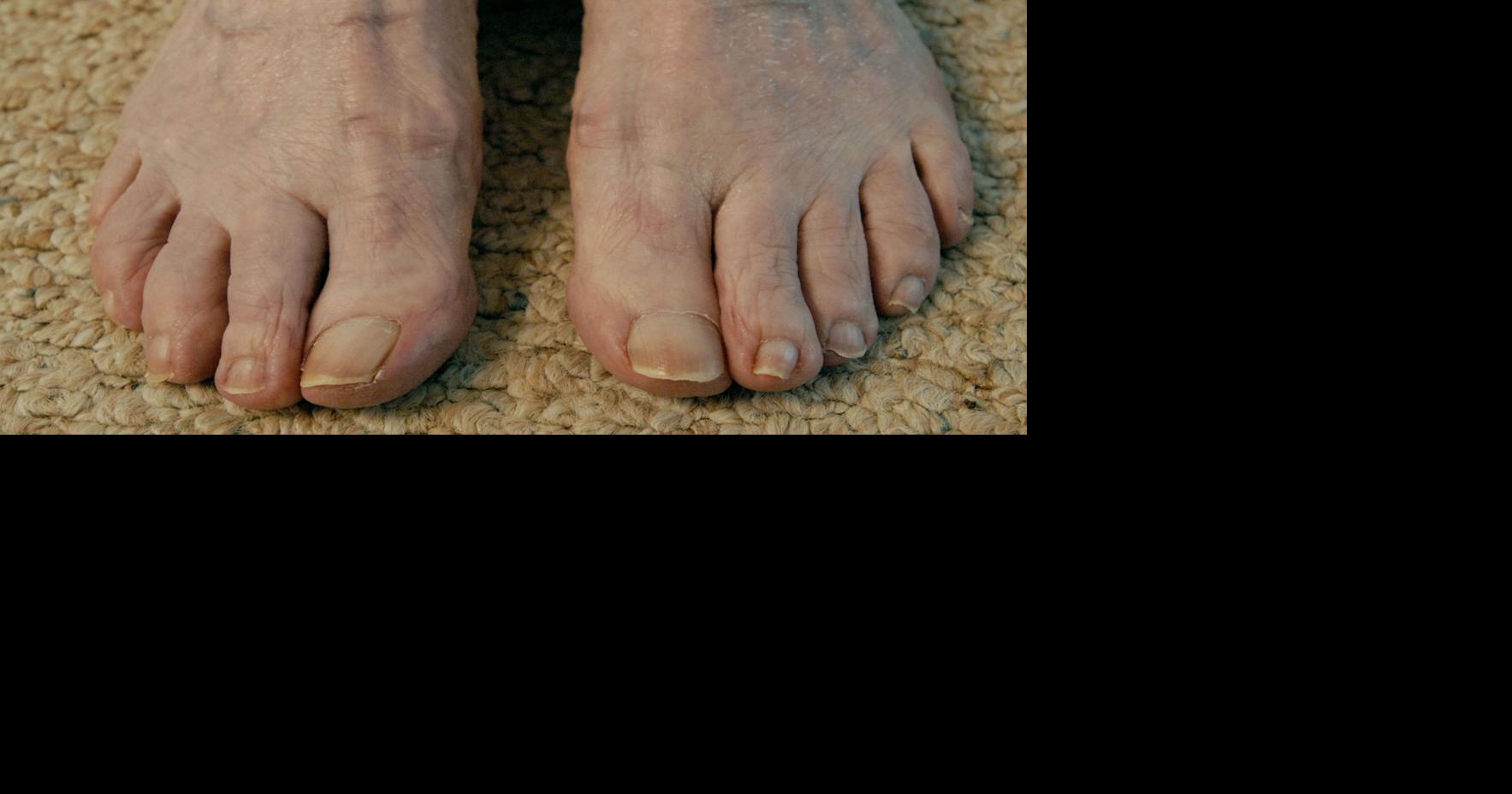 Toenail clipping service to be part of larger health event for seniors ...