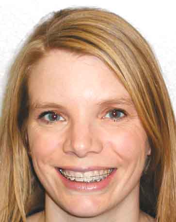 Candidate statement: Mandy Simons