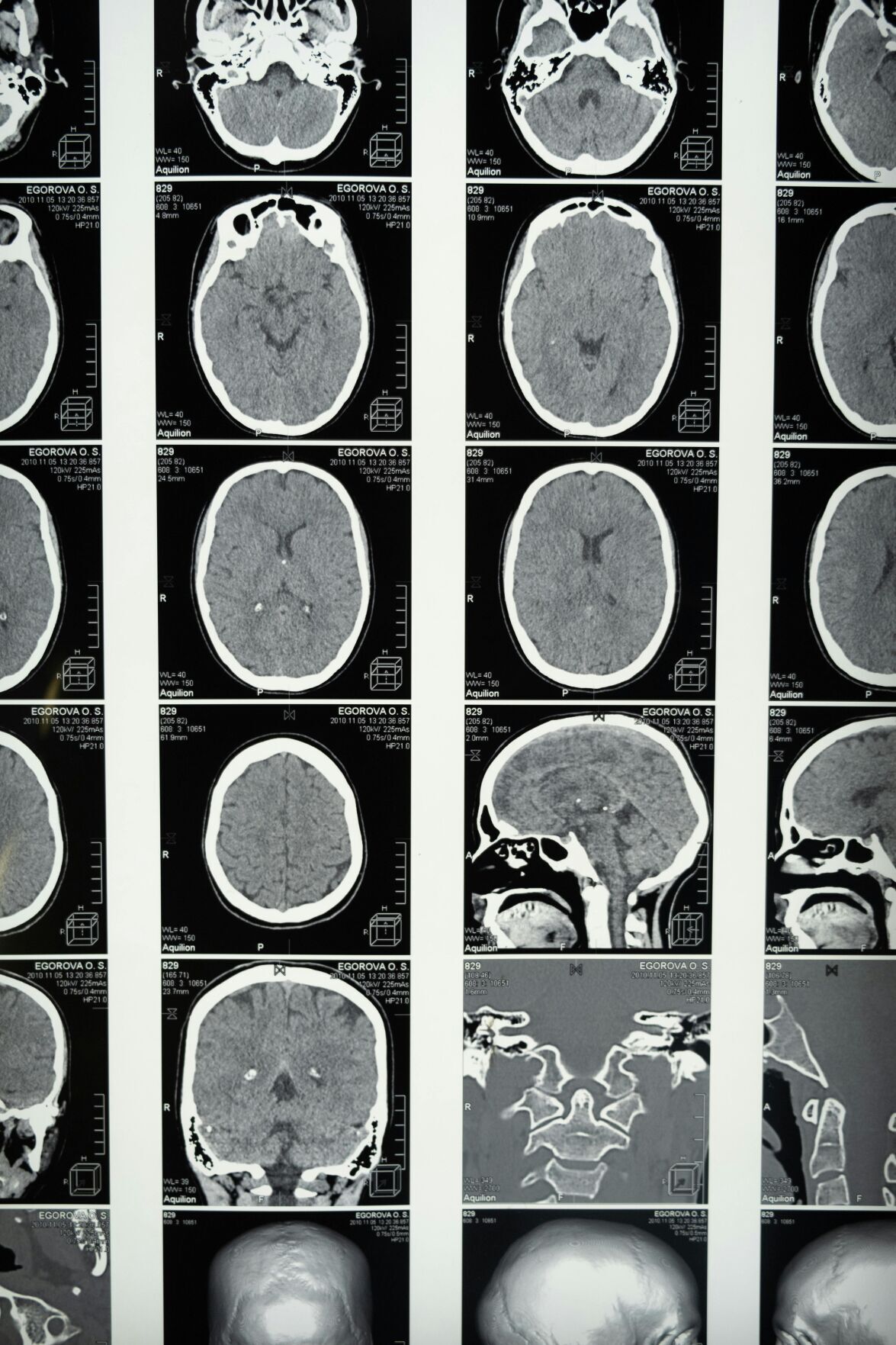 LECOM Health Corry Memorial Hospital PET/CT Imaging Program | News ...