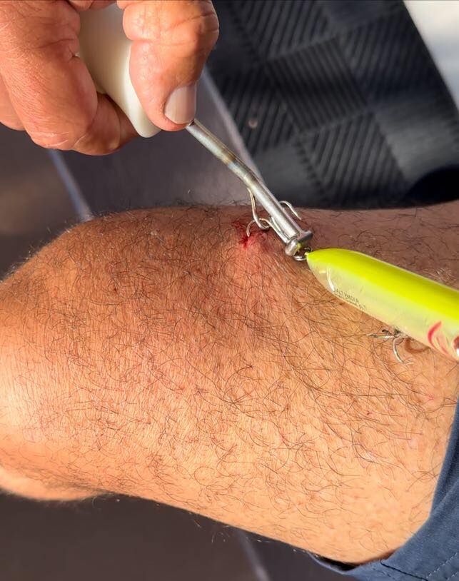 Introducing the DHUKR: A Revolutionary Fishhook Removal Tool | Press ...