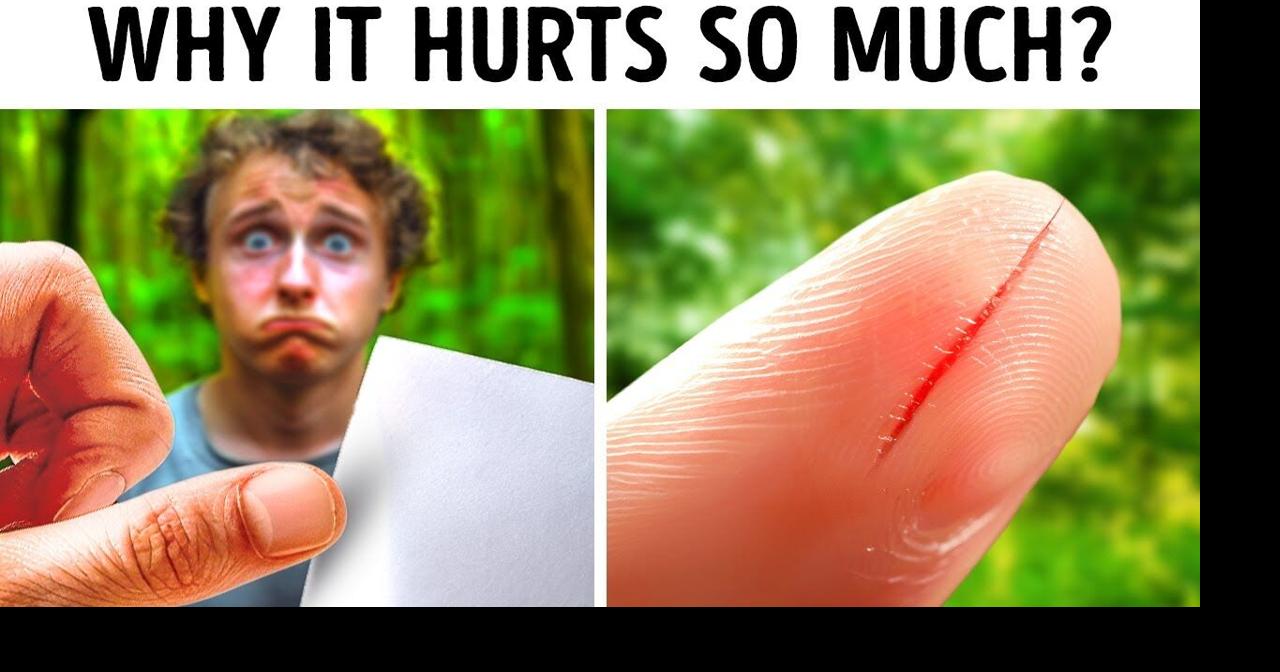 Why Paper Cuts Are So Painful (And Other Surprising Facts) | Videos ...