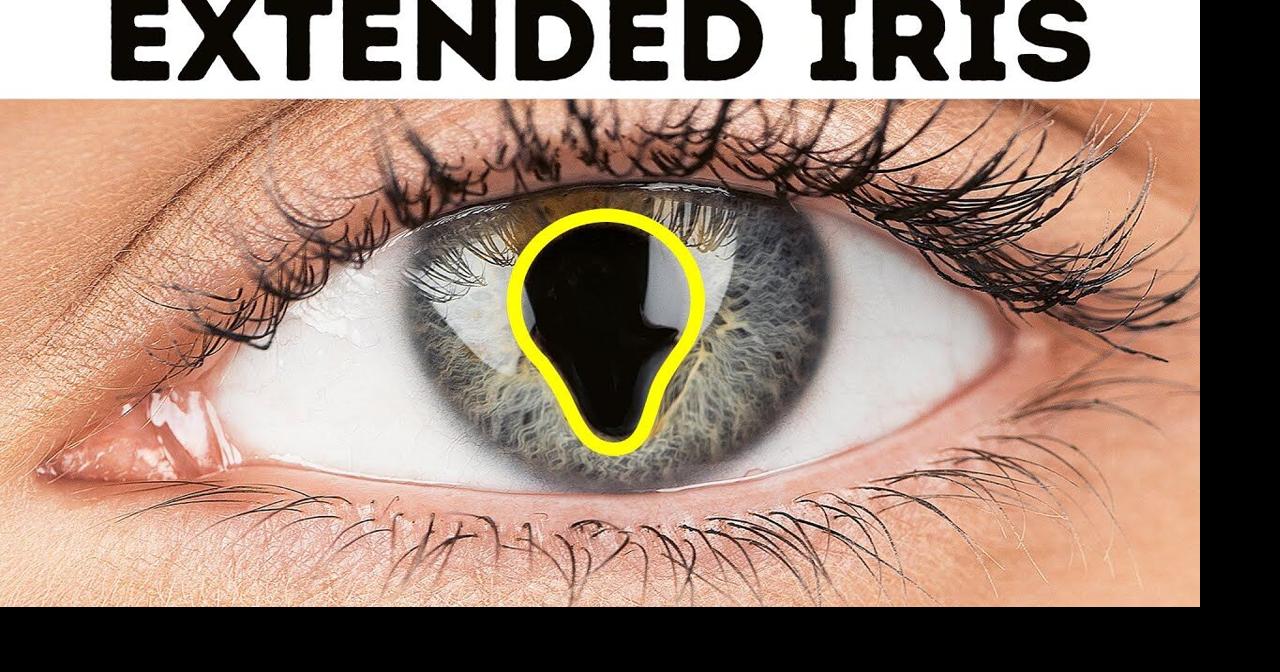 30+ Rarest Body Features You Might Have or Not | Videos | fltimes.com