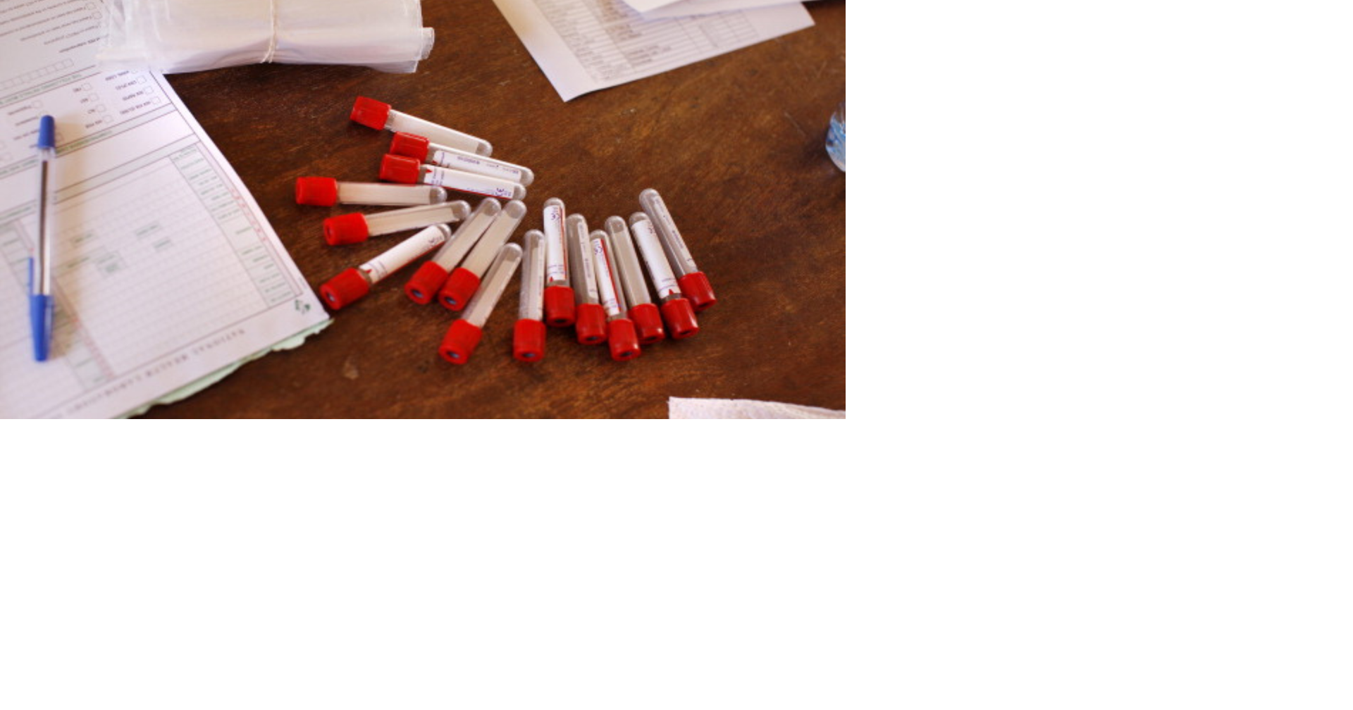 Free STI screening offered in honor of awareness week | Community ...