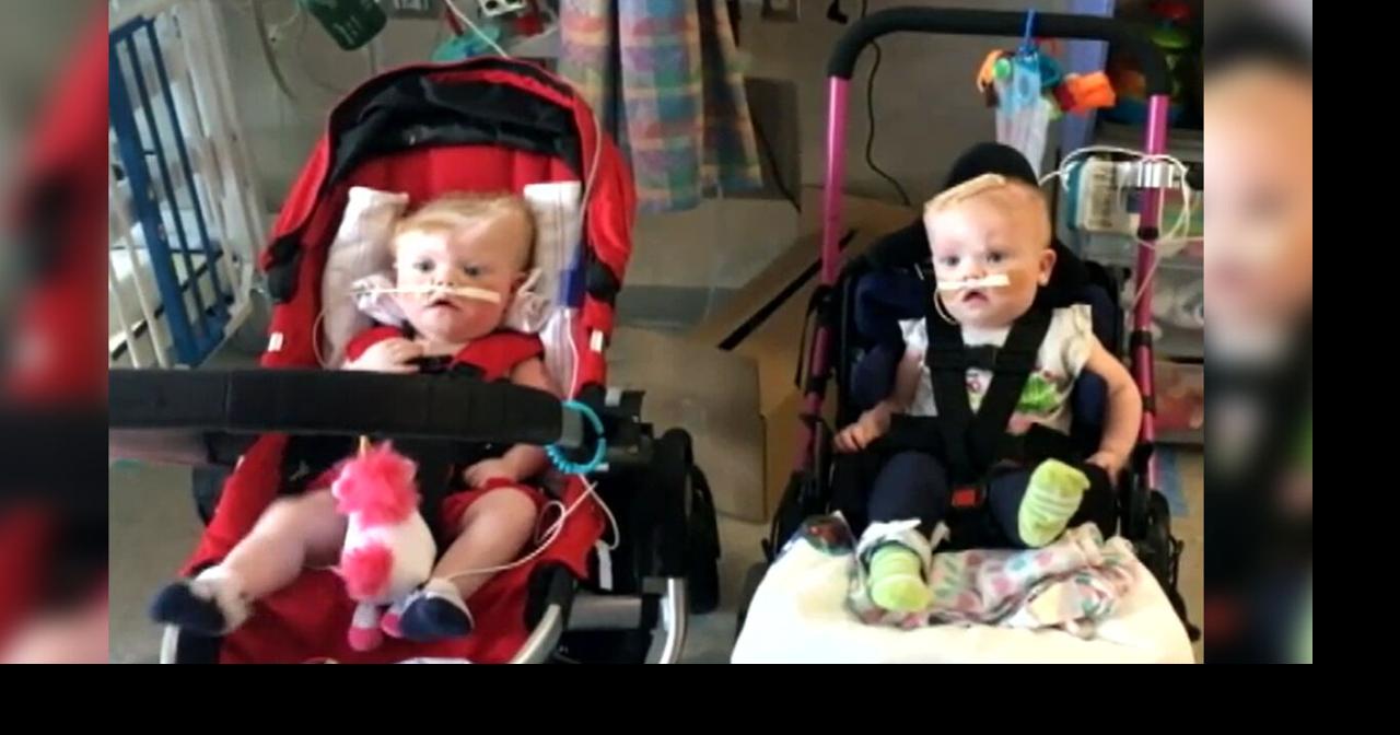 Conjoined twins thriving after surgery to separate them | Trending ...