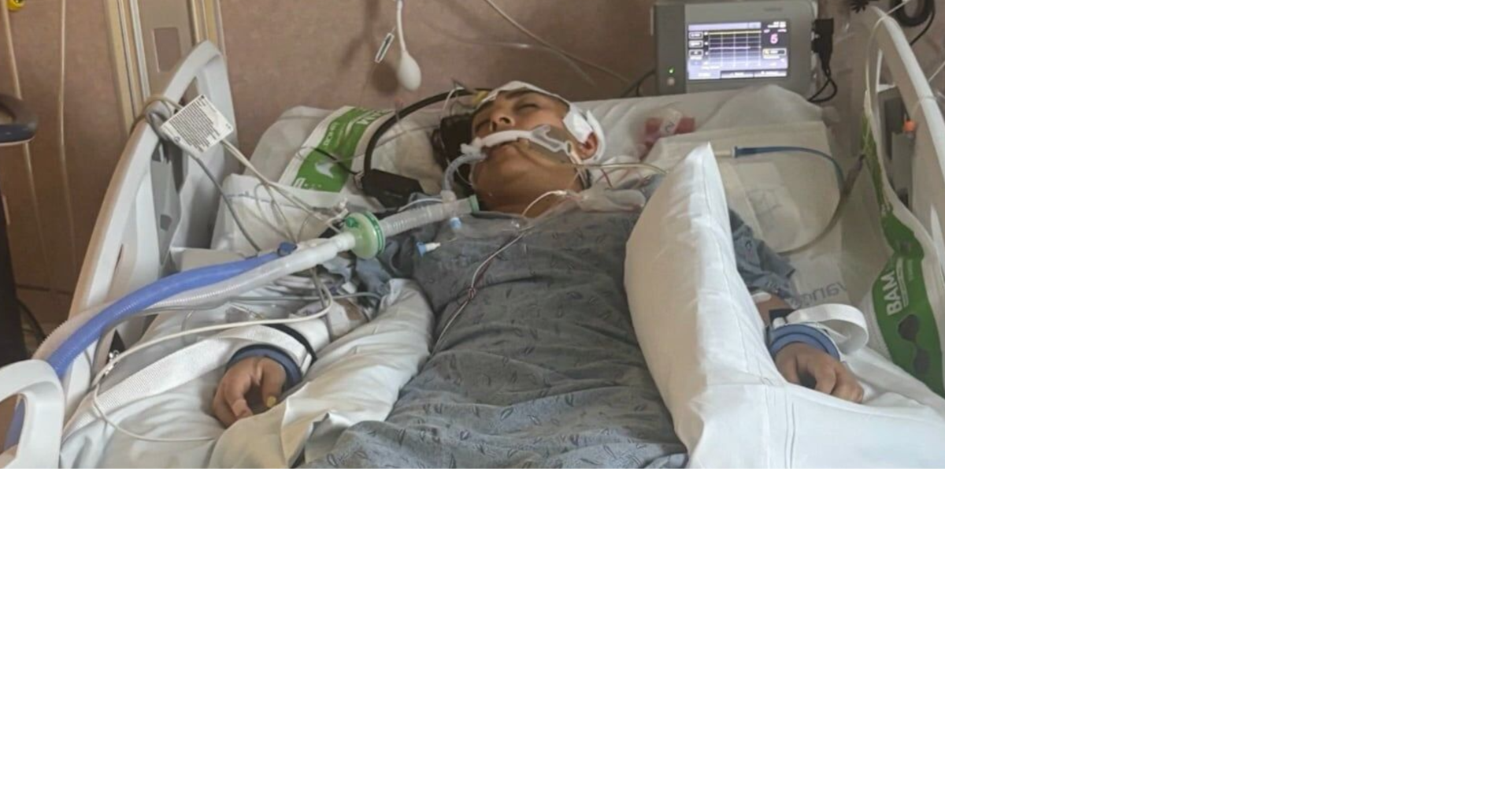 WATCH: Mid-South woman shot in the head by stray bullet fighting for ...
