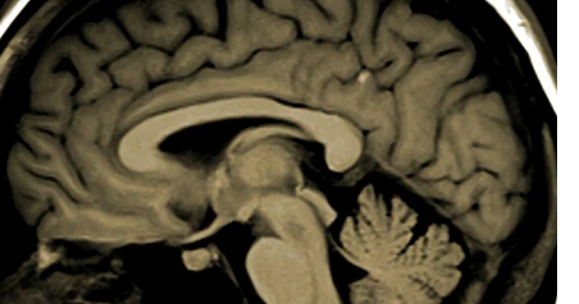 Life-threatening brain infections among children leaving doctors ...