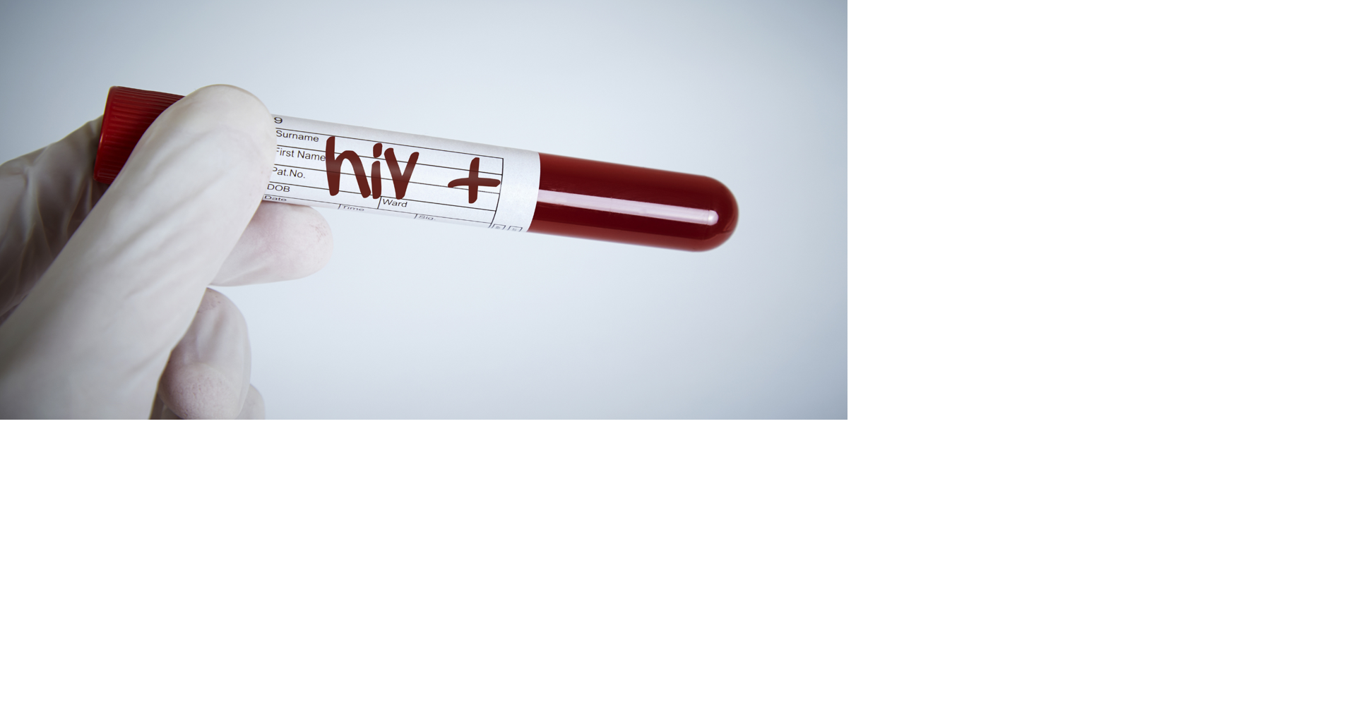 Shelby County Health Department hosting National HIV Testing Day event ...