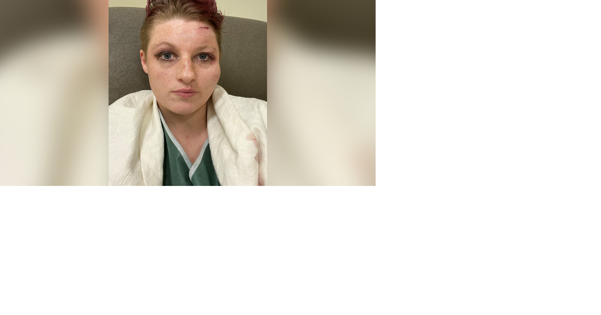 Memphis Uber driver recovering after alleged attack by passenger | News ...