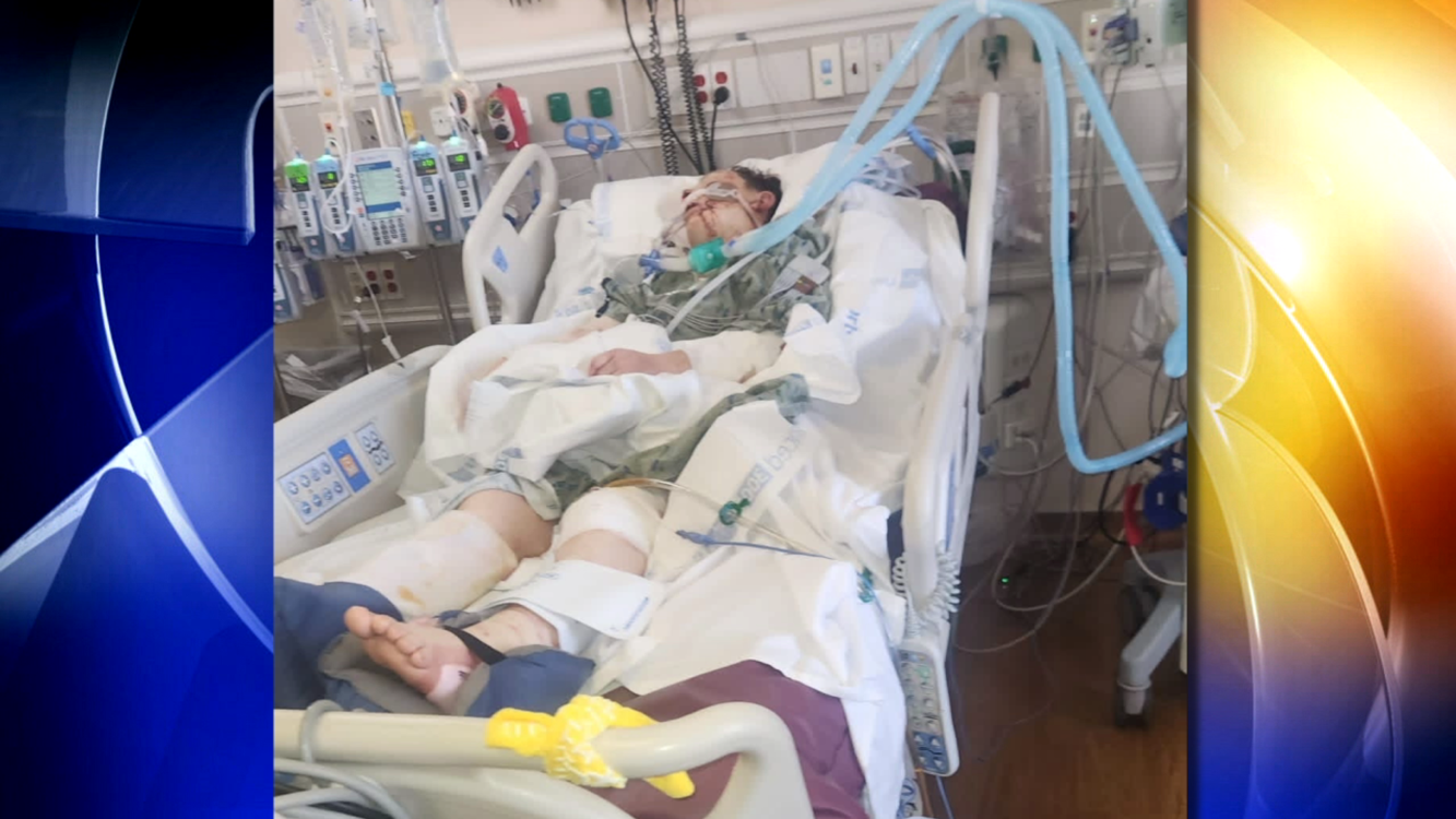 Unidentified animal attack leaves McAlester mother fighting for life ...