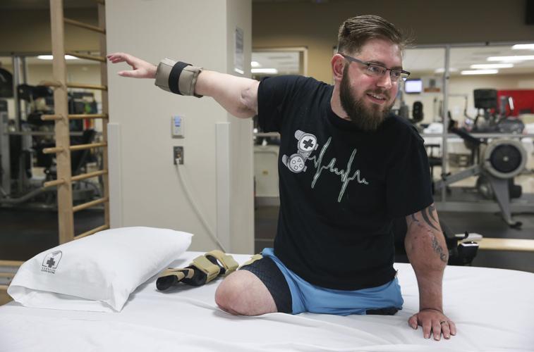 Afghan war vet writes love letter to wife after double arm transplant