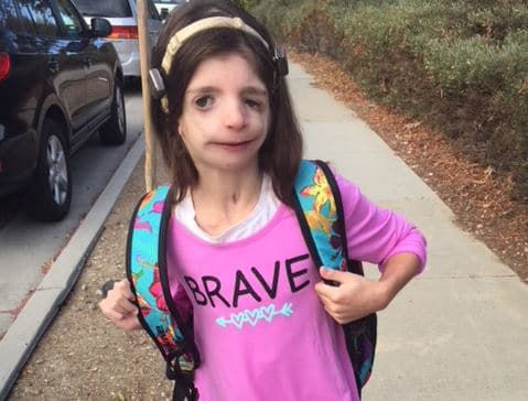 'I'm more awesomer': How kids with facial differences are reacting to ...