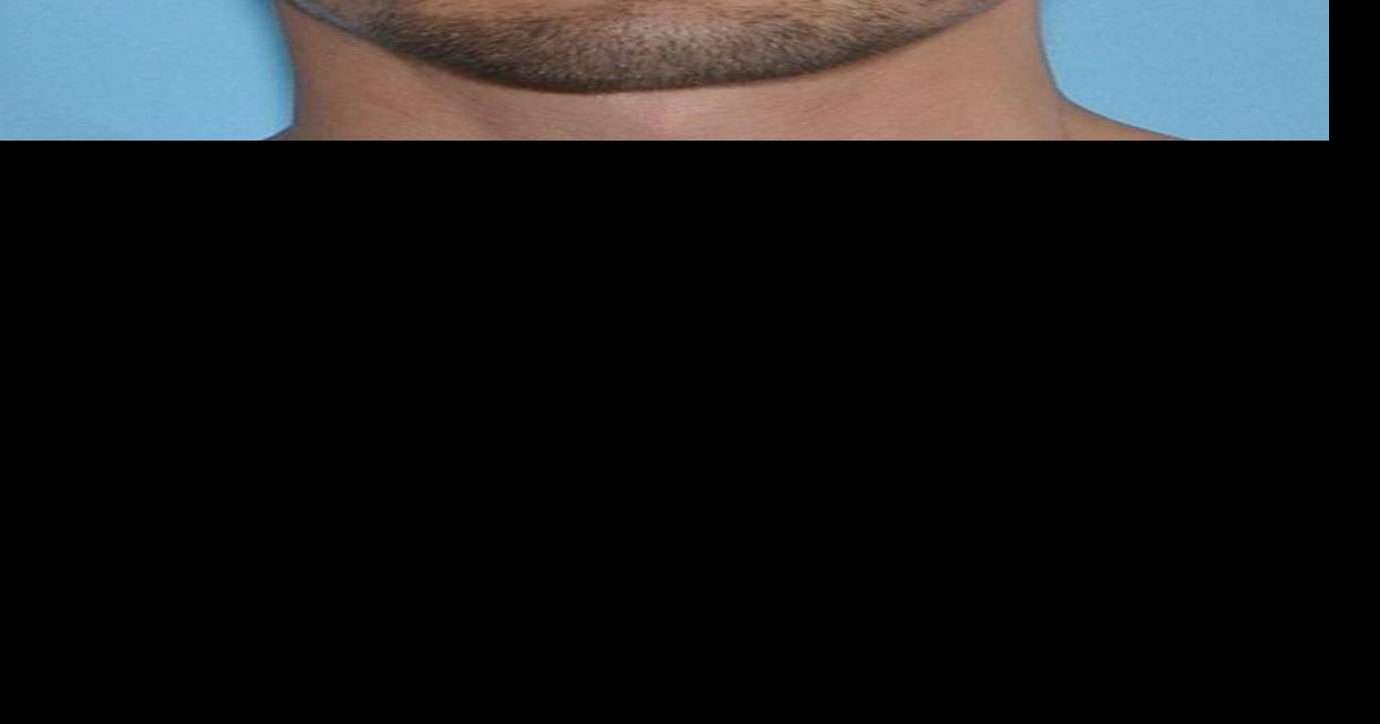 Anchorage fugitive arrested in Wasilla | Local News | frontiersman.com