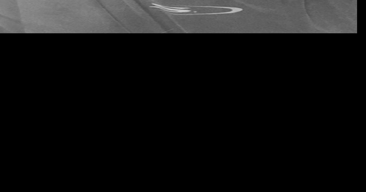 William “Bill” Mrak, Jr. | Archives | frontiersman.com