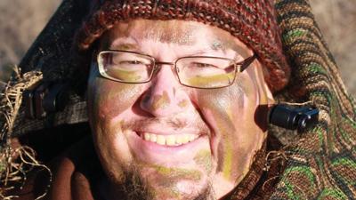 Man with rare disease gets 1st treatment | News | glendalestar.com