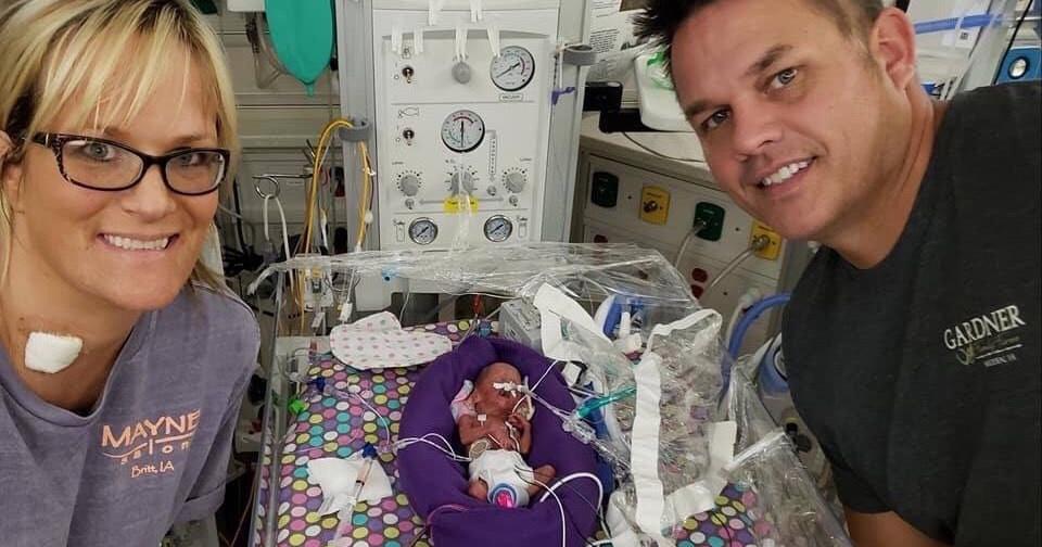Photos: Woden couple's journey after daughter born at 23 weeks