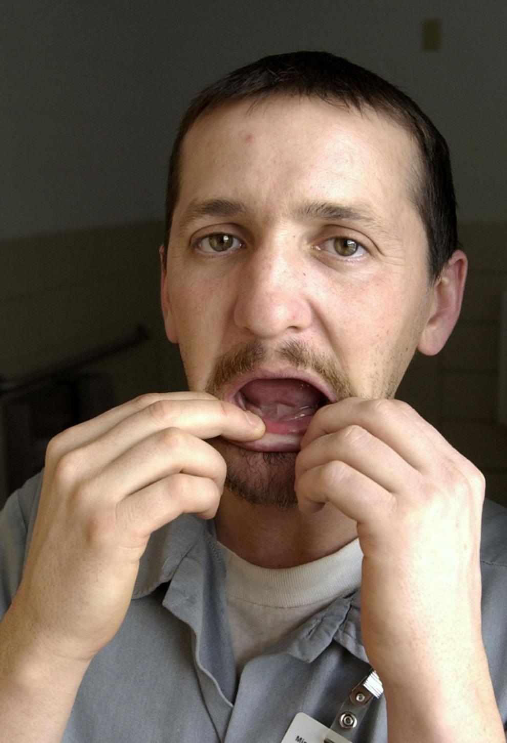 What other effects do chronic meth users experience?