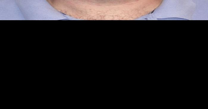 MCRHC hosts third annual Pucker-up Pig Run