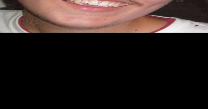 Garrett Rodney Carlson, Northwood