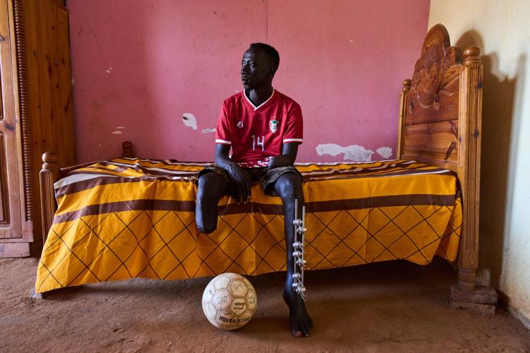 The scars of war among survivors in Sudan | National News | goshennews.com