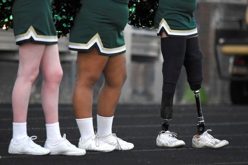 Double amputee transcends role of cheerleader | Local Sports ...