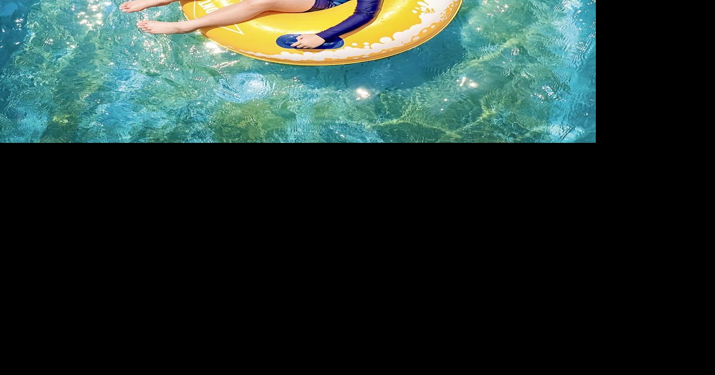 Tips To Deal With Kids' Common Summer Injuries | Health ...