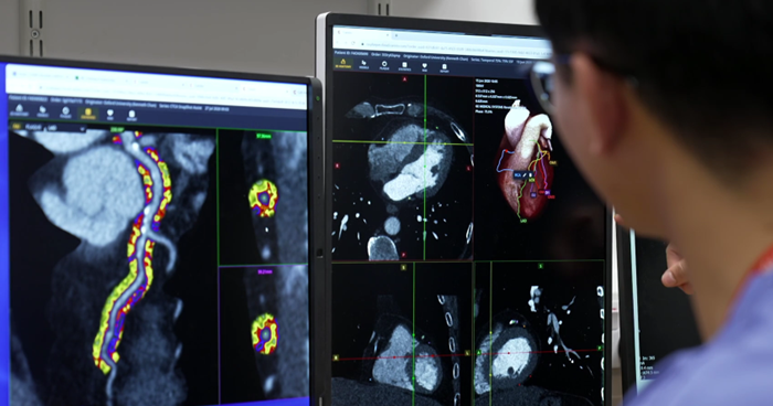 NCH Adopts AI Tools to Detect Heart Attack Risks Early | Health Care ...