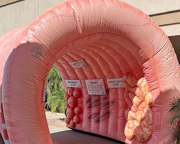 Educational inflatable at Havasu Regional Medical Center raises colon ...
