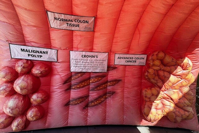 Educational inflatable at Havasu Regional Medical Center raises colon ...