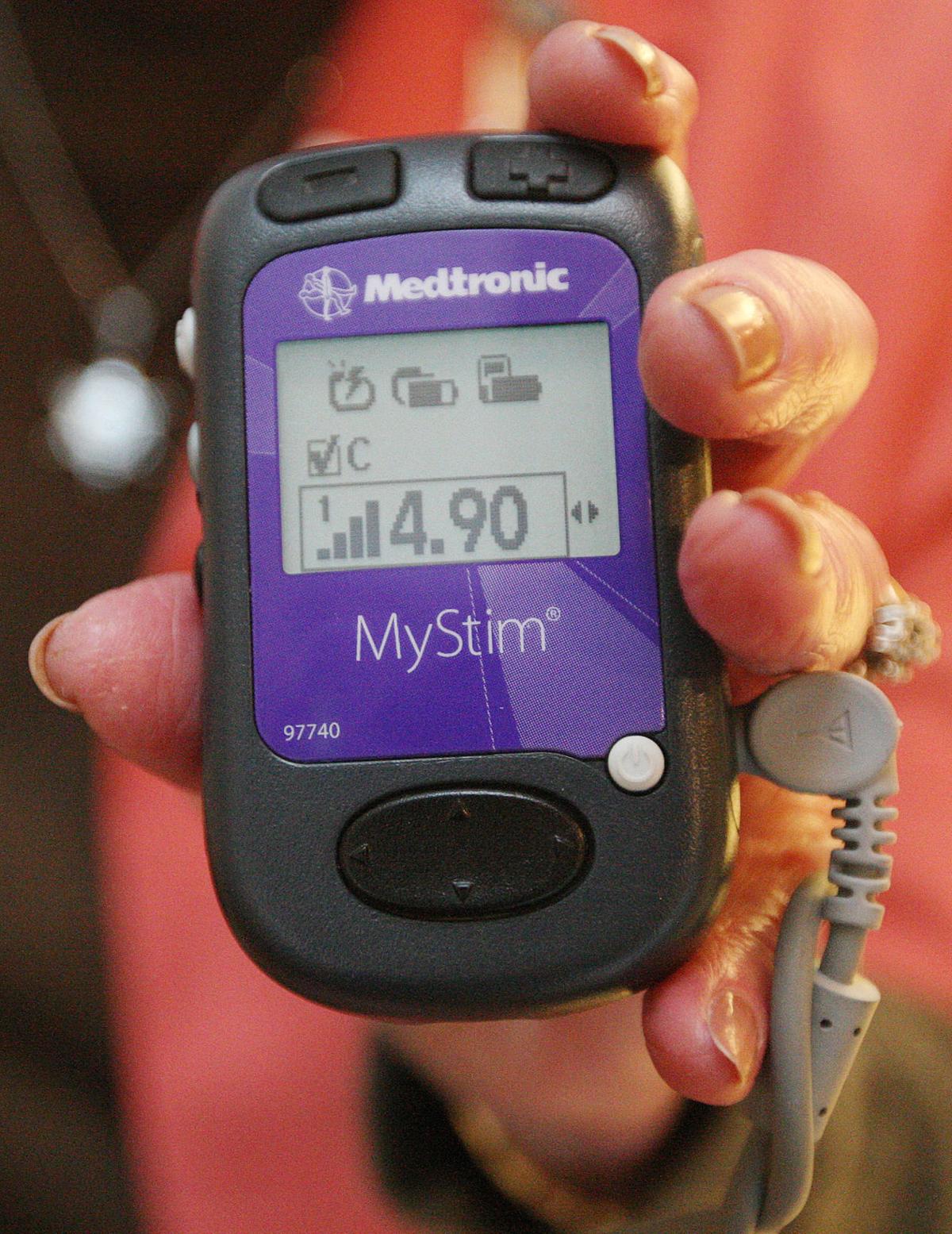 Relief at the source: Spinal implants disrupt pain signals for many ...