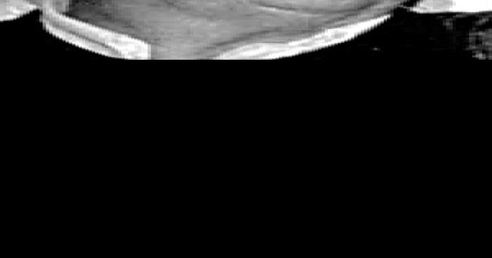 Fitzgibbons, David Gerald