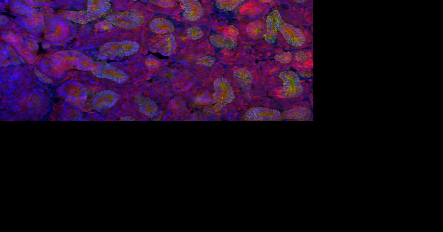 Rat kidneys grown in mice offer new hope for transplant patients ...