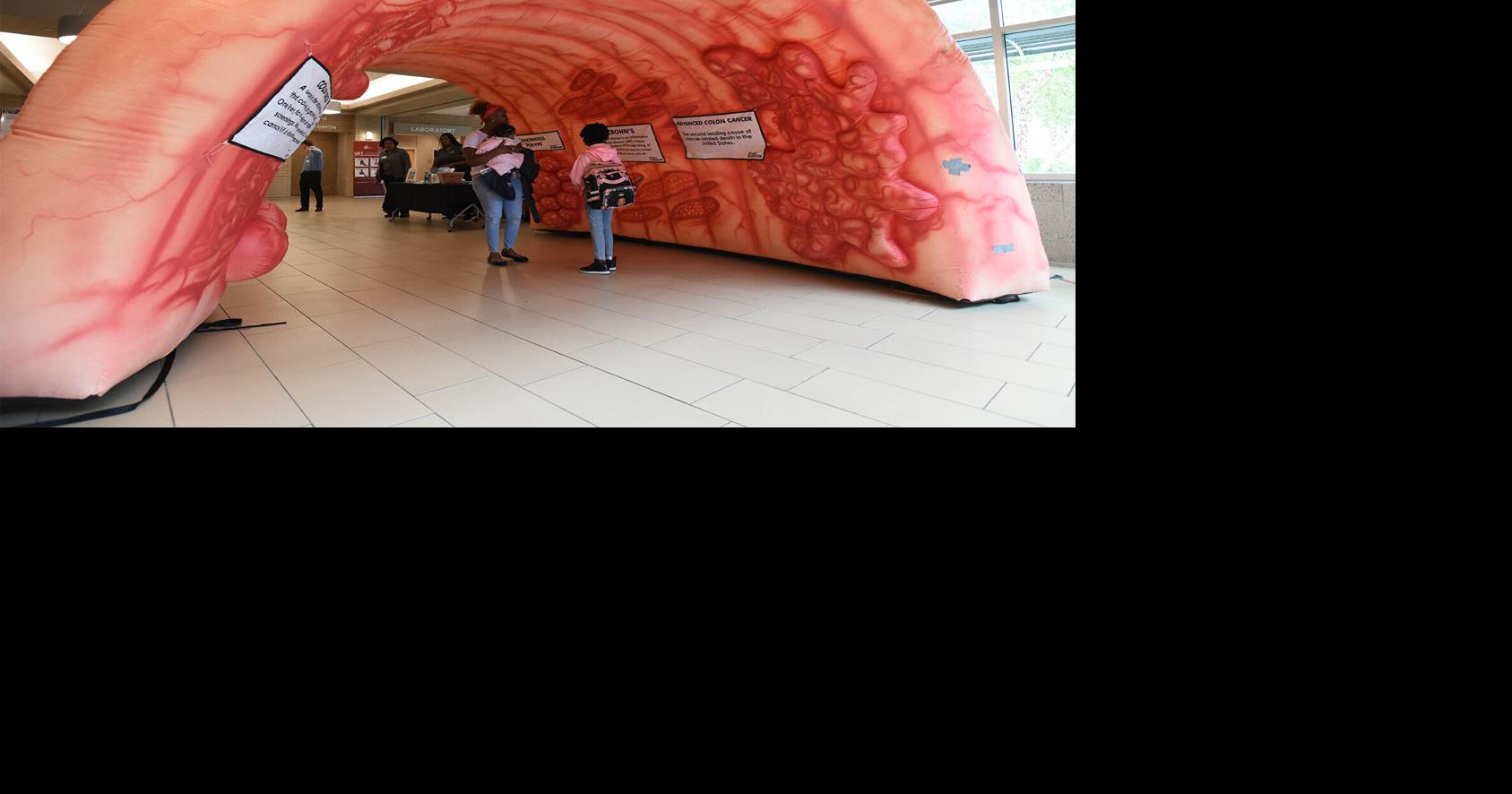 InterCare Community Health Network displays inflatable colon for ...