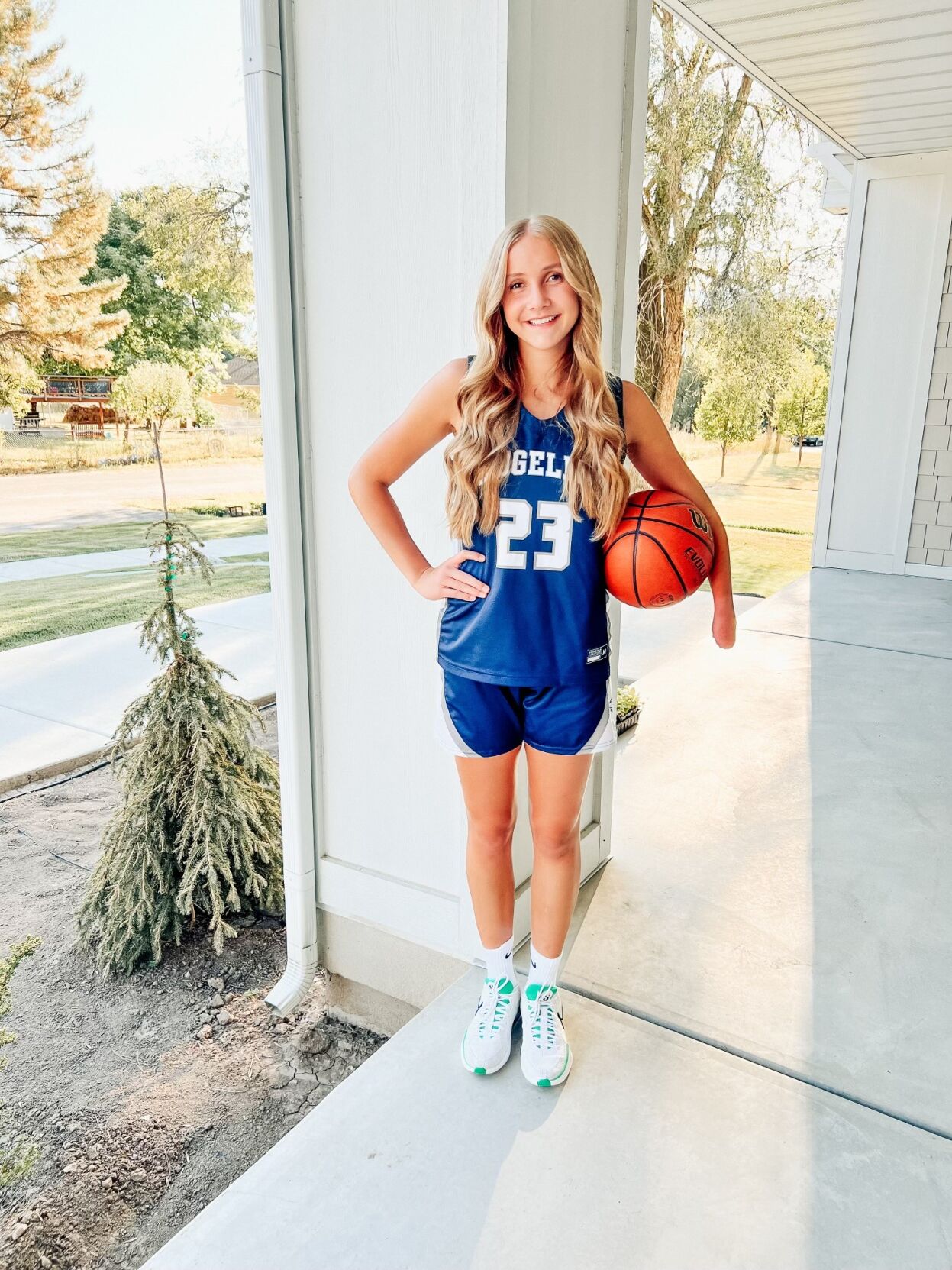 Addition by subtraction: Girl born with underdeveloped hand continues to make the most of ...