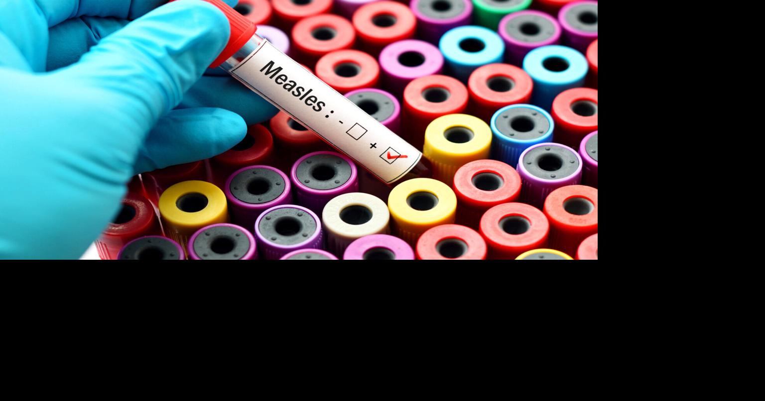 Measles outbreaks across Utah highlight risk to babies and pregnant ...