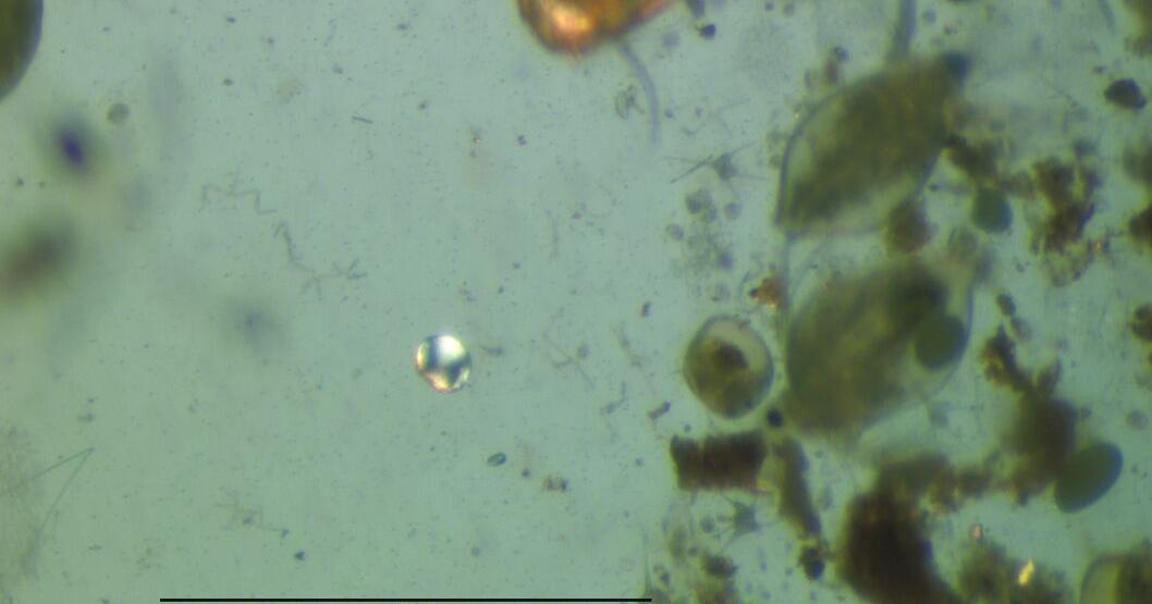 Zebra mussel larva confirmed in Goose Lake | Local News ...