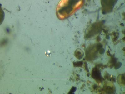 Zebra mussel larva confirmed in Goose Lake | Local News ...