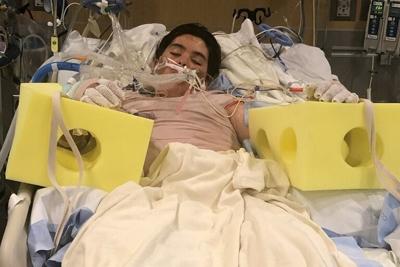 Boy severely burned at Fort Hall on life support but expected to ...